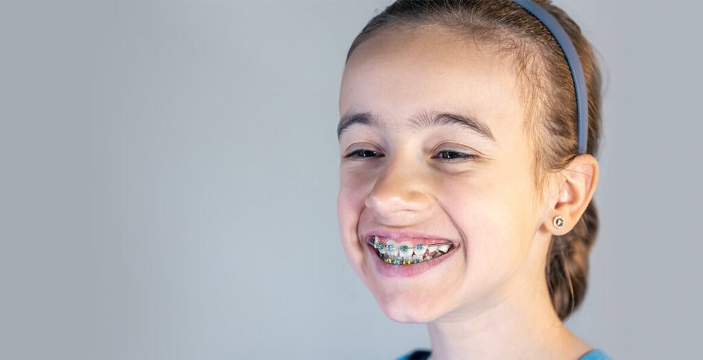 Comprehensive Guide To Braces For Kids